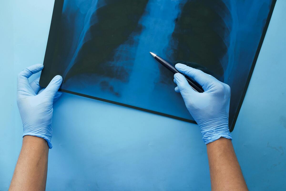 Does Medicaid Cover Breast Reduction? Benefits Explained